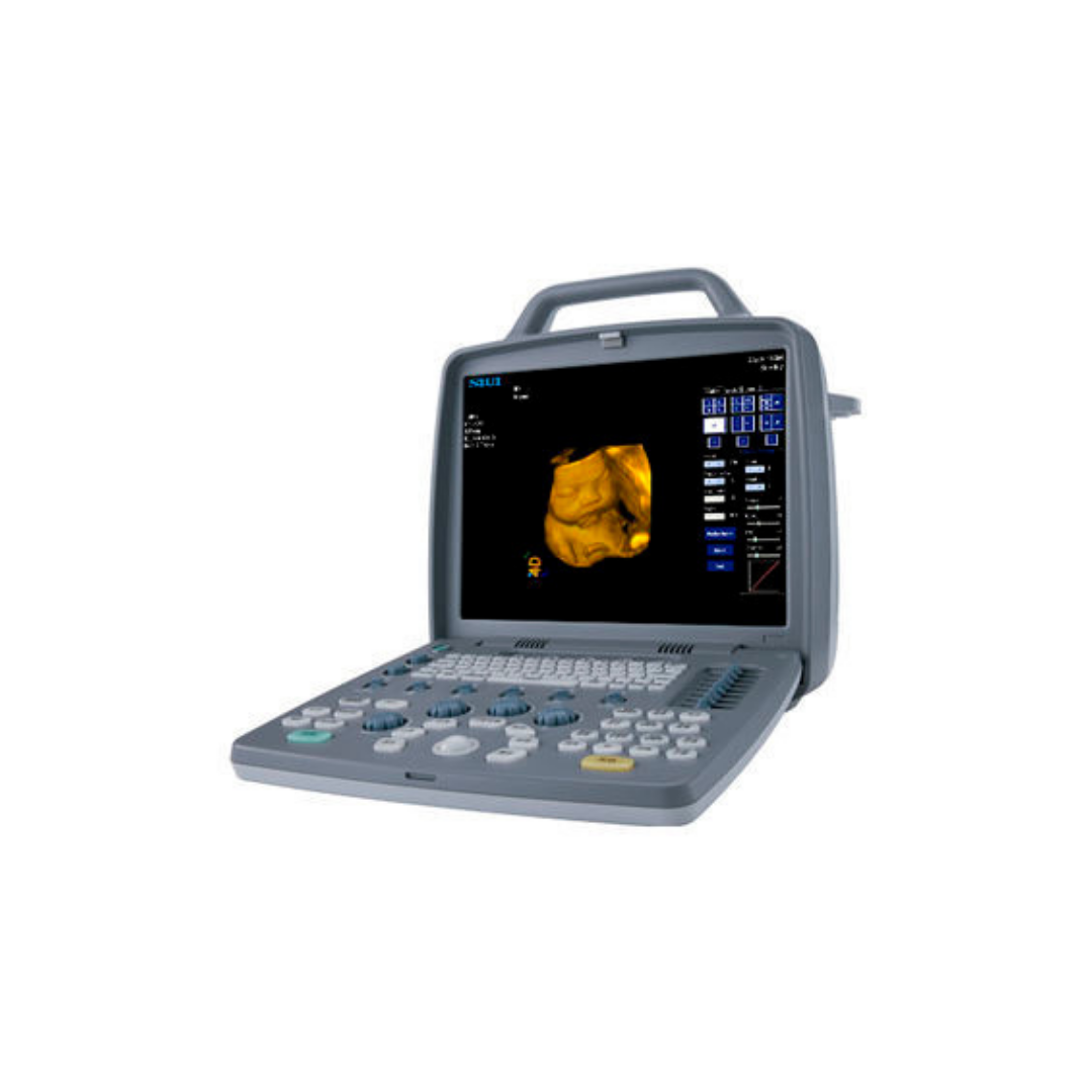 Ultrassom Doppler colorido – sunt